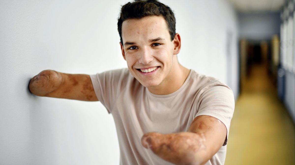 Théo Curin, nageur amputé des 4 membres : « Il faut être fier de sa ...